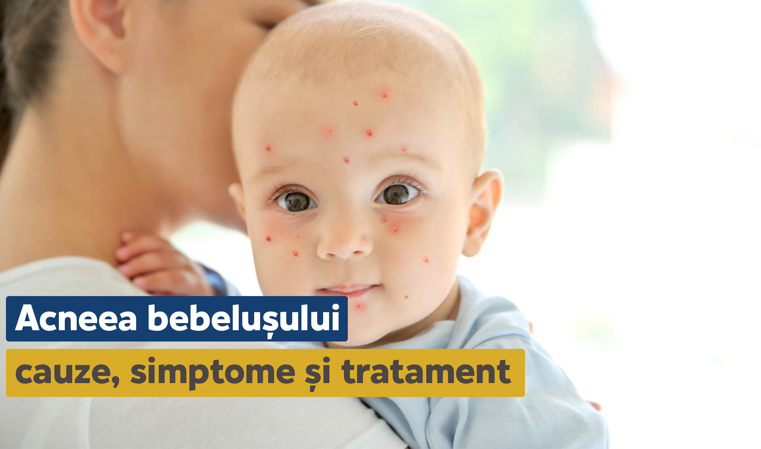 Totul despre acneea bebelușului – simptome, cauze și tratament ...