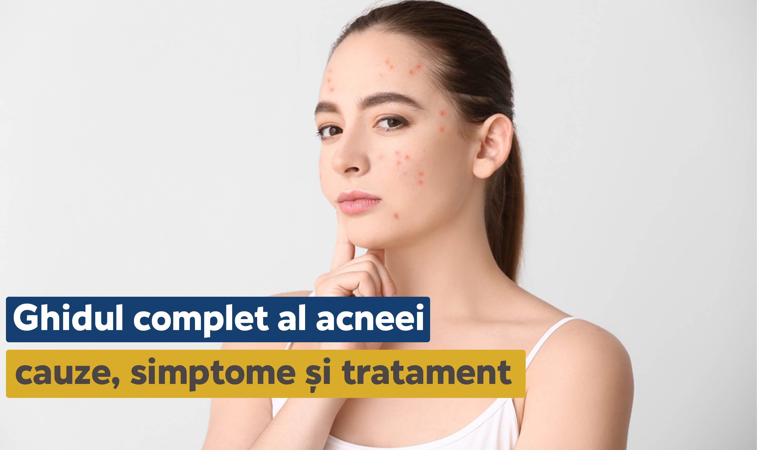 Ghidul complet al acneei – simptome, cauze și tratament - Centrul ...