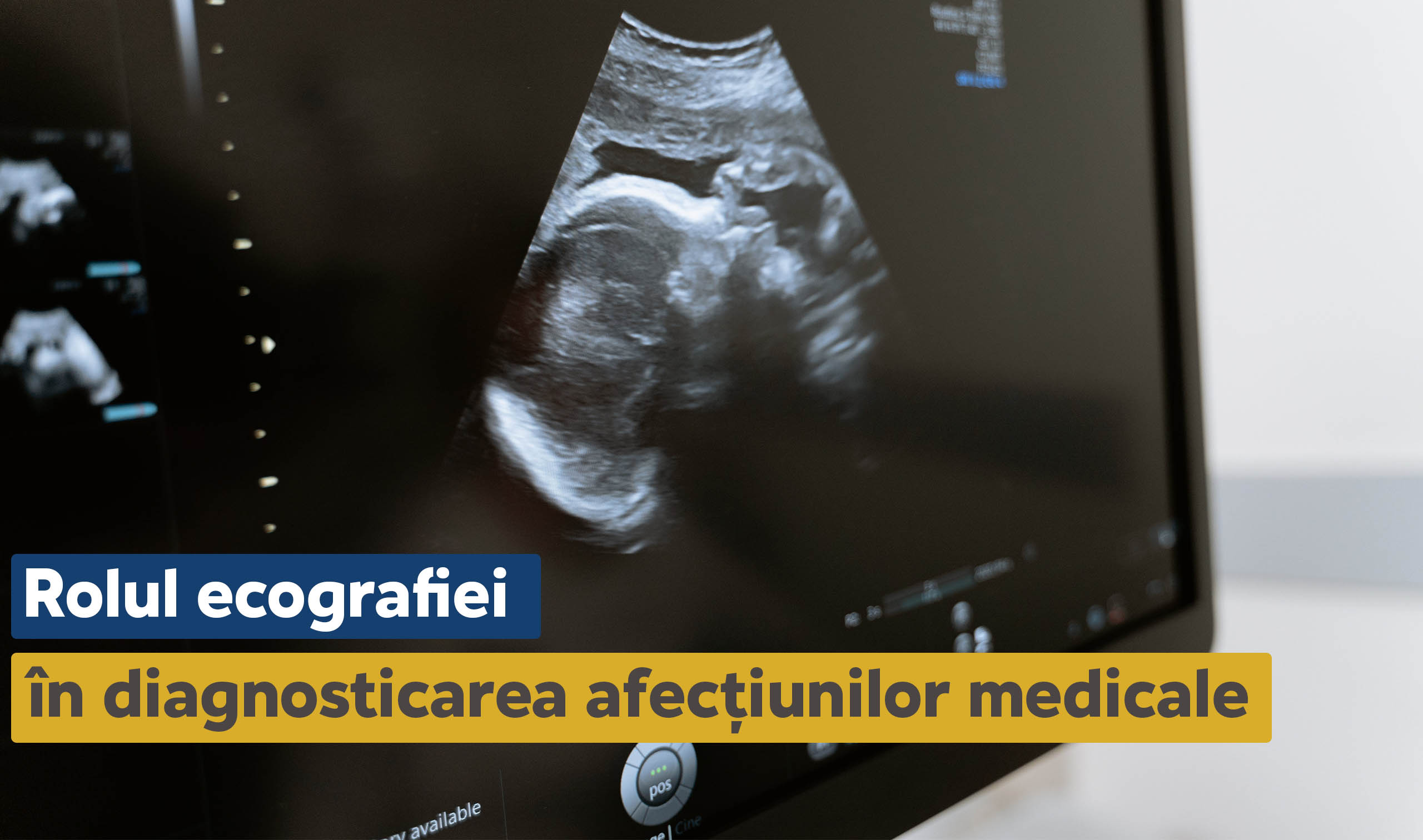Rolul ecografiei în diagnosticarea precoce a afecțiunilor medicale ...